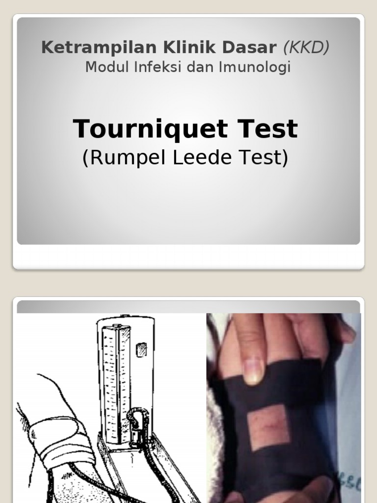 5 Tourniquet Test Rumpel Leede Test by DR Didiek | PDF