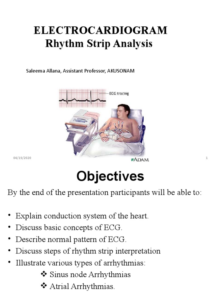 Rhythm Strip Analysis (Revised) | PDF | Electrocardiography | Cardiac ...