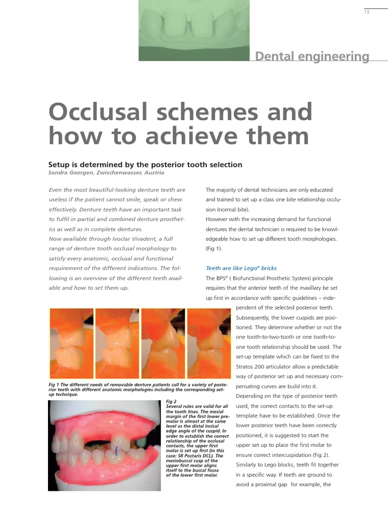 Occlusal Schemes and How To Achieve Them | PDF | Dentures | Tooth