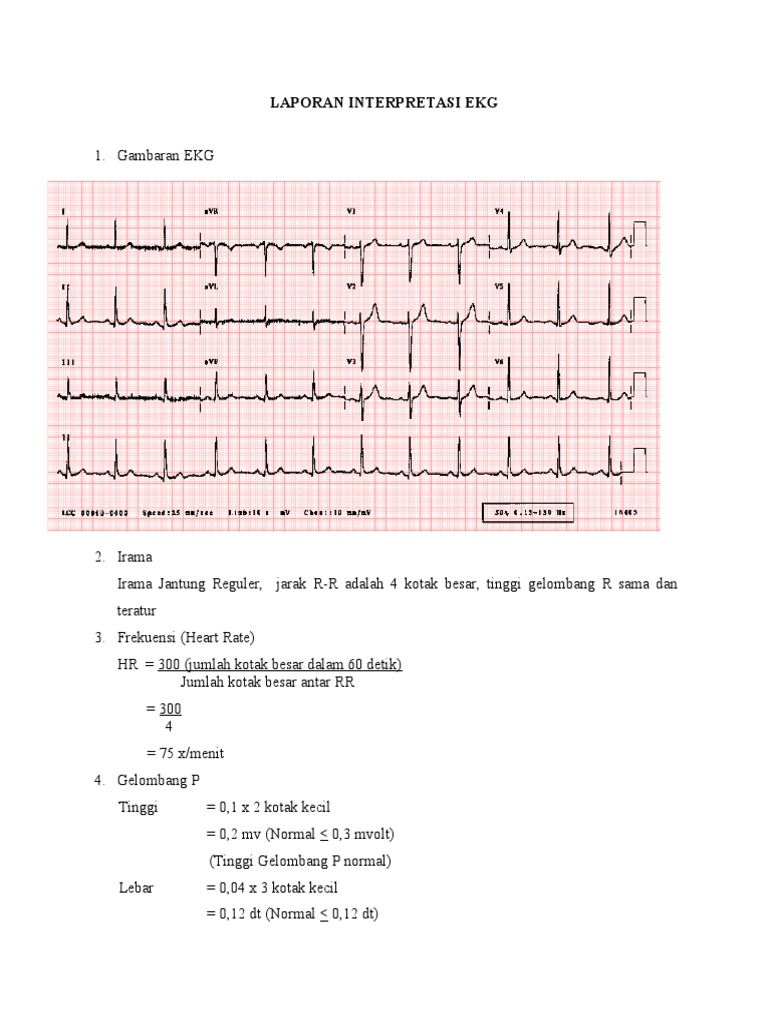 Laporan Interpretasi Ekg | PDF