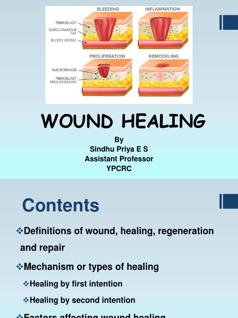 Wound Healing and Repair PDF | PDF | Wound Healing | Healing