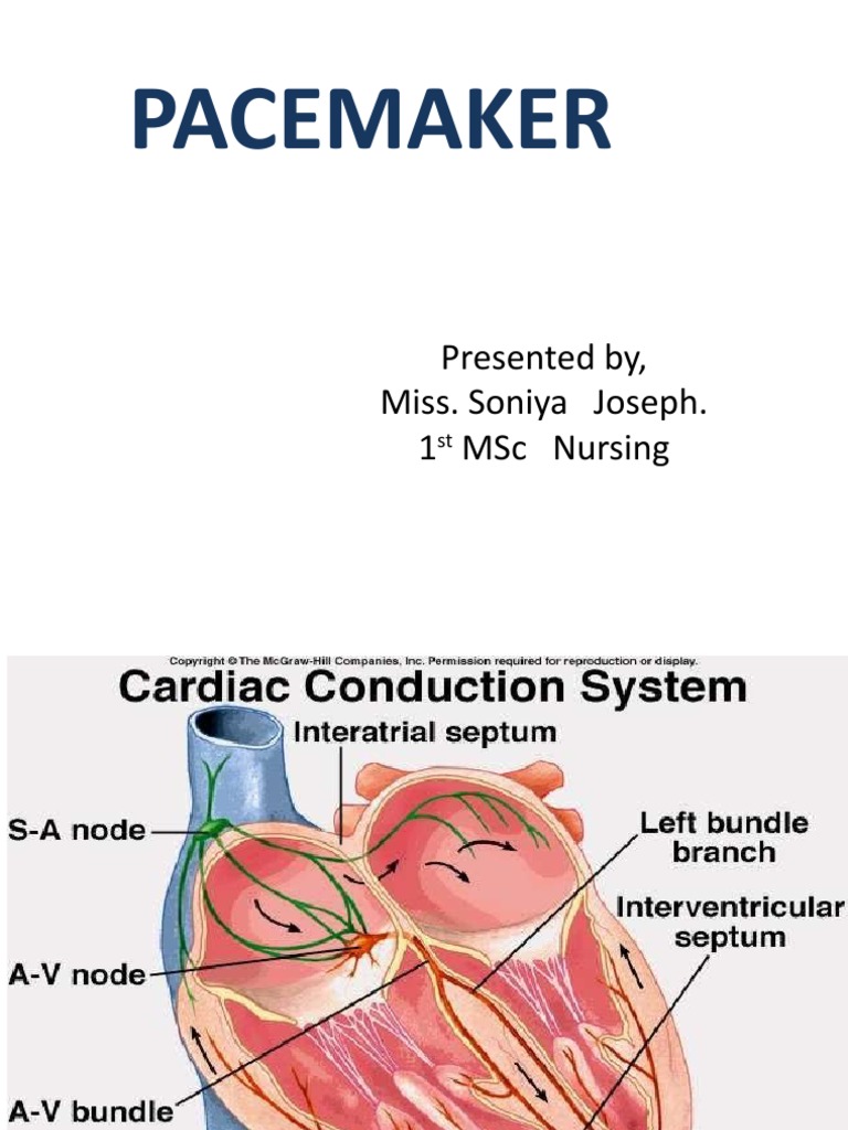 Pacemaker | PDF | Artificial Cardiac Pacemaker | Atrium (Heart)