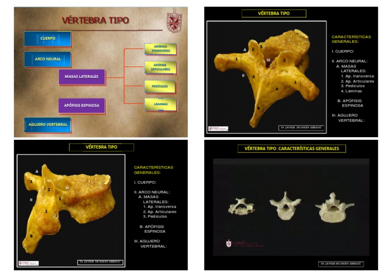 Características de la Vértebra Tipo | PDF | Vértebra | Anatomía
