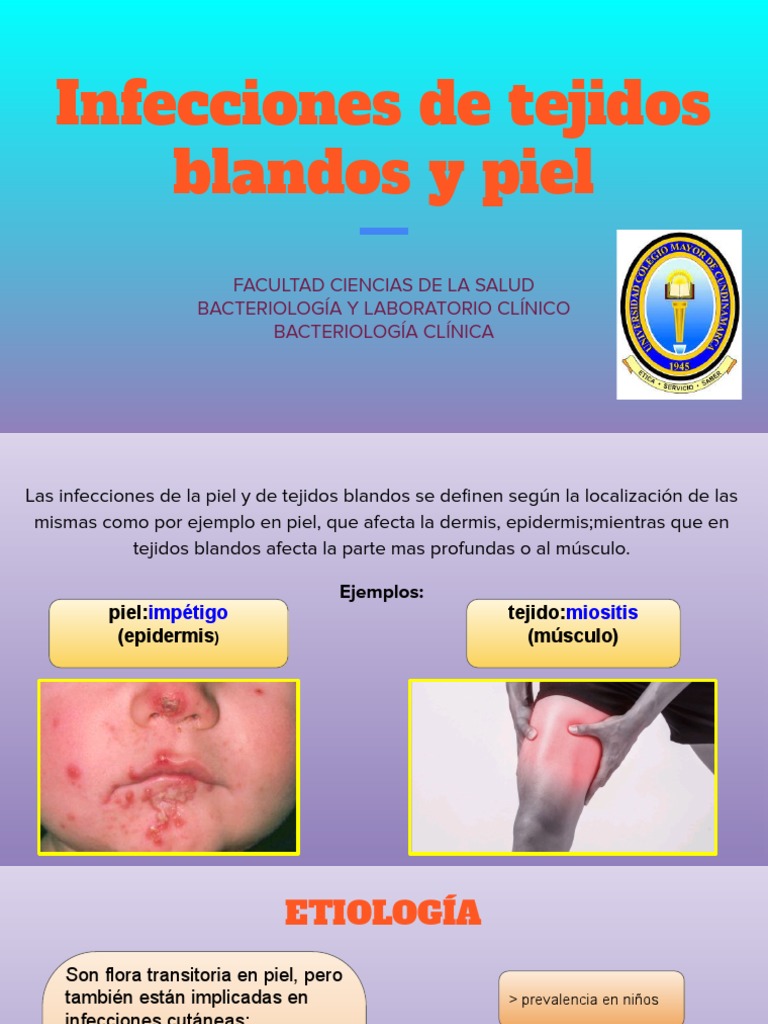 Infecciones de Tejidos Blandos | PDF | Ciencias de la Salud | Medicina