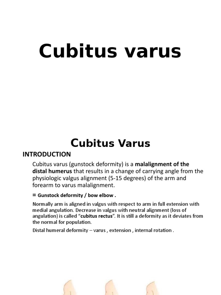 Cubitus Varus, Elbow Joint, Mitali Joshi | PDF | Elbow | Limbs (Anatomy)