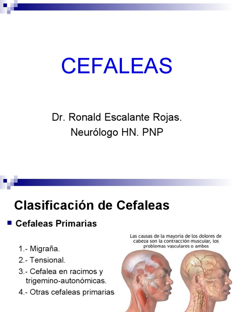 CEFALEA | PDF | Migraña | Trastornos episódicos y paroxísticos