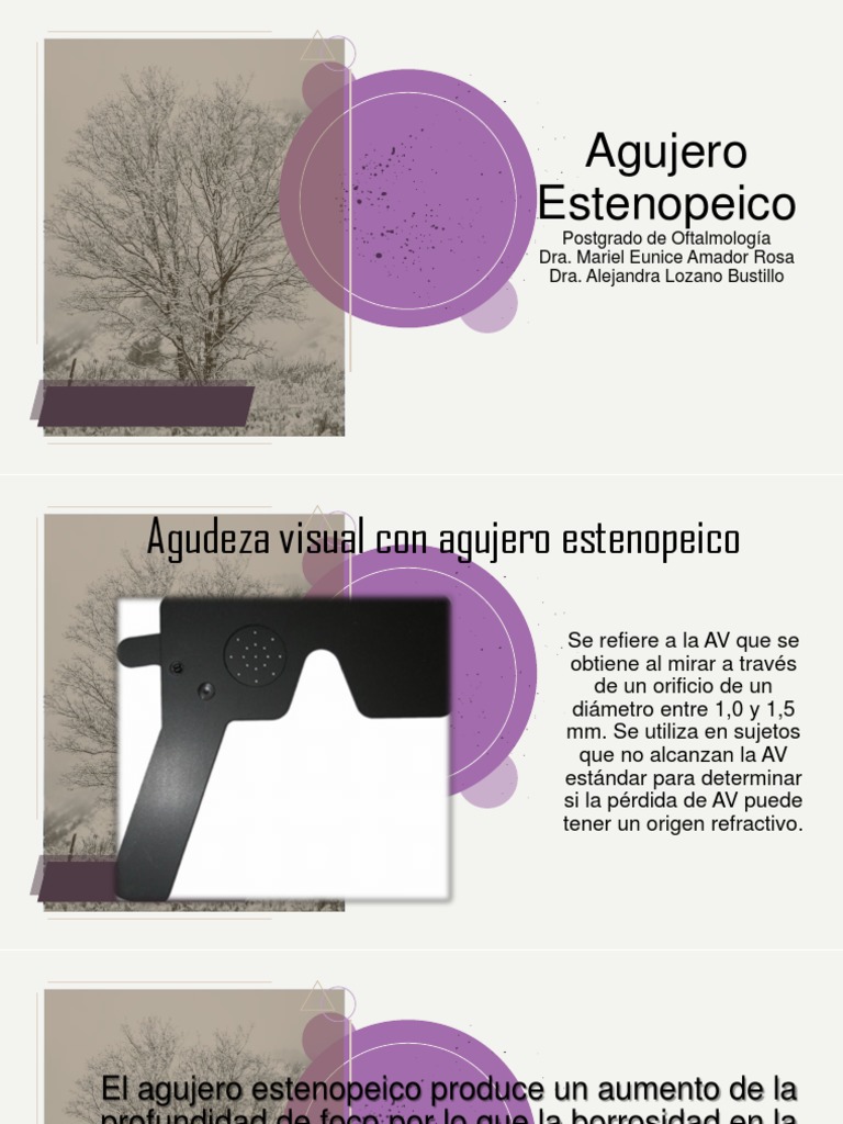 PRESENTACION 2 Agujero Estenopeico PDF | PDF