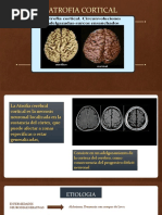 Escala de Zarit | PDF | Medicina CLINICA | Ciencias de la Salud