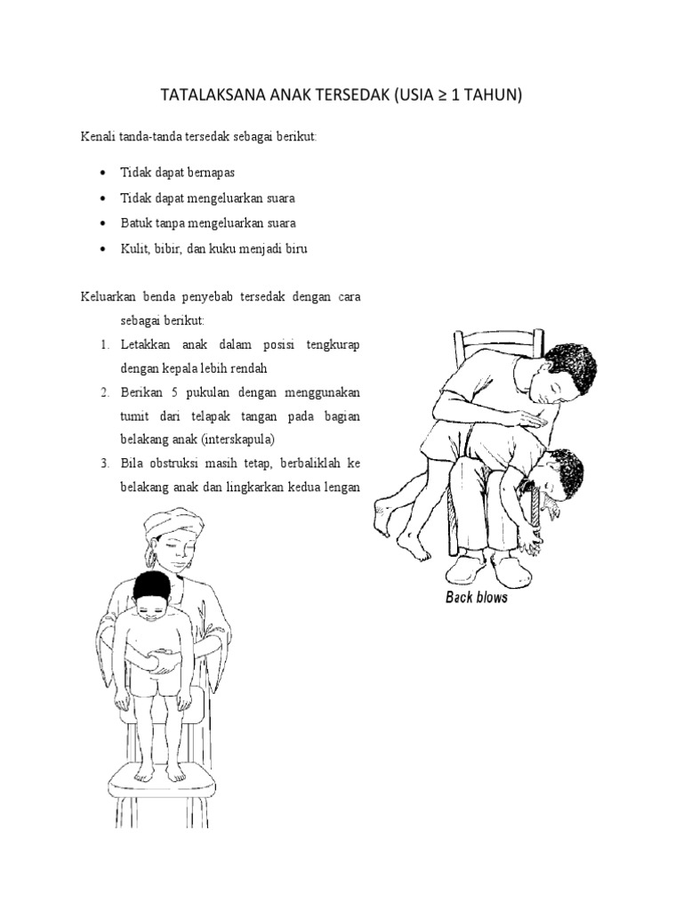 Tatalaksana Anak Tersedak | PDF