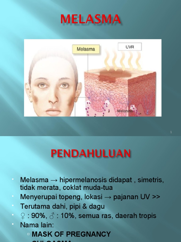 Melasma | PDF