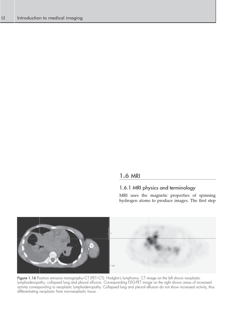 Magnetic Resonance Imaging | PDF | Magnetic Resonance Imaging ...