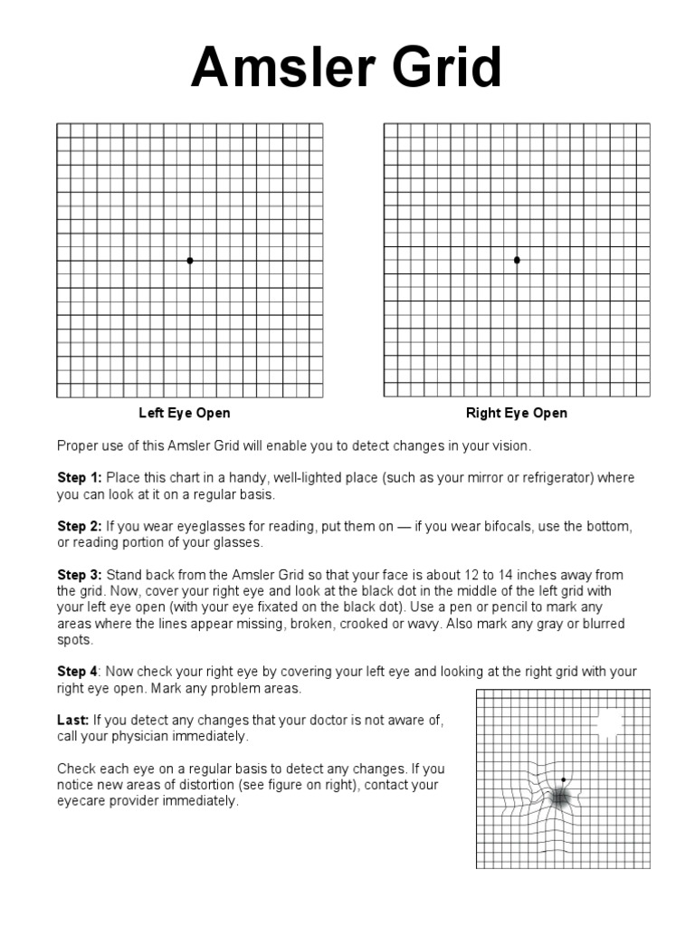 Amsler Grid