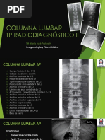 Osteofitos y su Impacto Clínico | PDF | Hueso | Sistema musculoesquelético