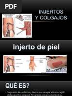 Escarotomía y Escarectomía en Quemaduras | PDF | Quemar | Herida