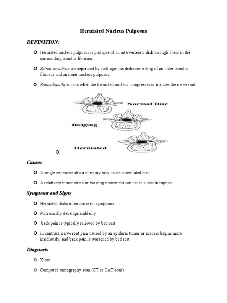 Definition:: Herniated Nucleus Pulposus | PDF