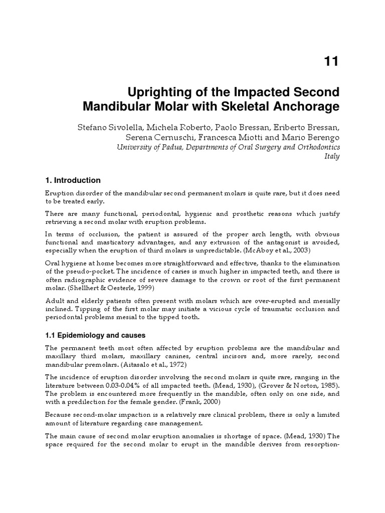 Uprighting Impacted Mandibular Molars | PDF | Human Tooth | Dental Implant