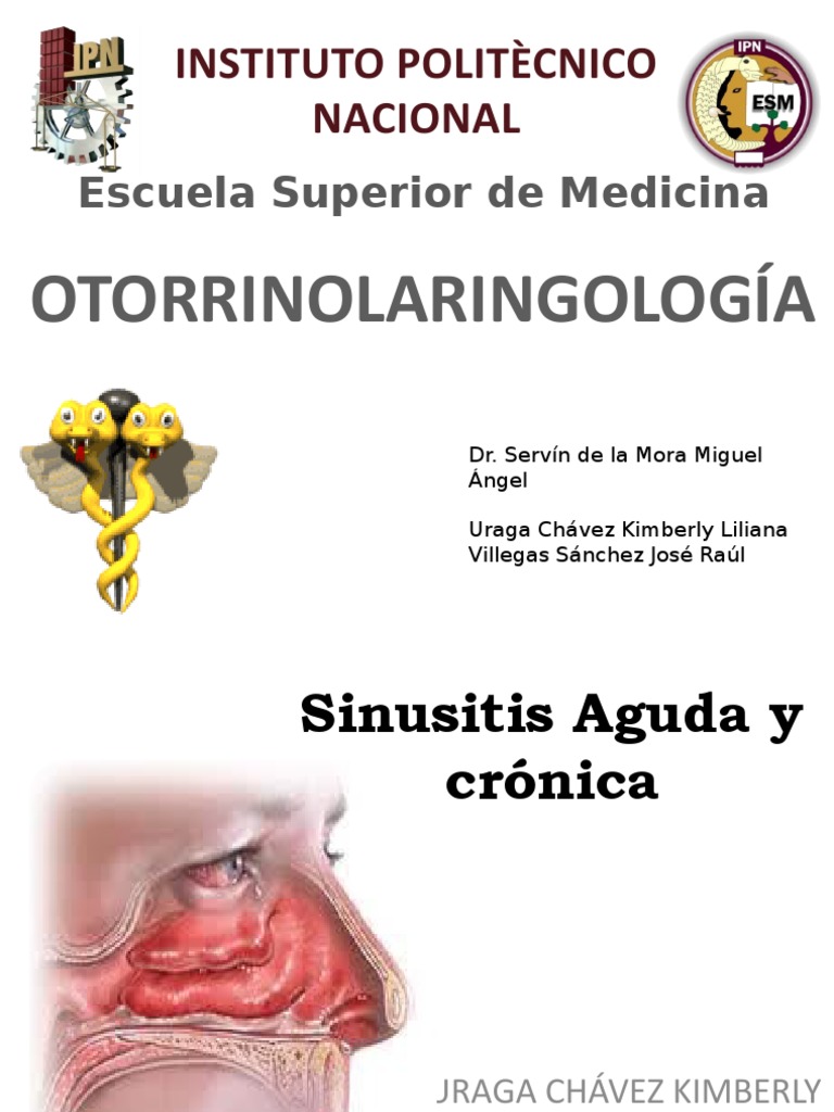 Sinusitis Aguda y Cronica | PDF | Enfermedades y trastornos | Cabeza y cuello humanos