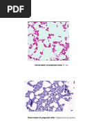 Simple Staining of E. coli and S. aureus | PDF | Staining | Bacteria