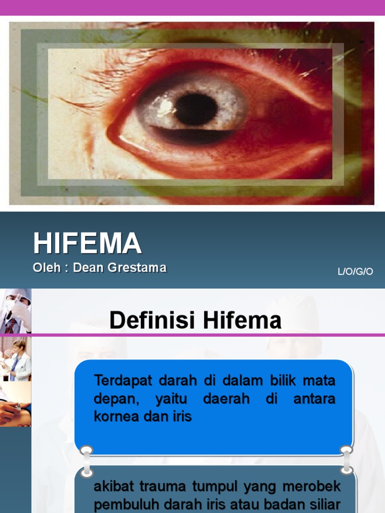 Hifema | PDF