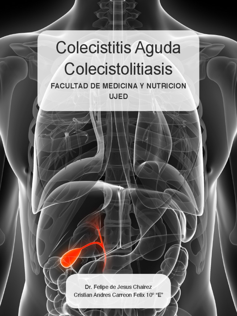 Colecistitis - Colecistolitiasis | PDF | Hígado | Vesícula biliar