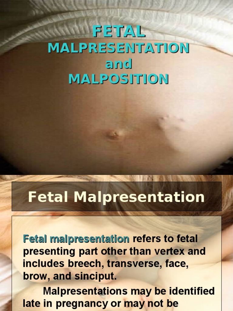 Types of Fetal Malpresentation Explained | PDF | Childbirth | Caesarean ...