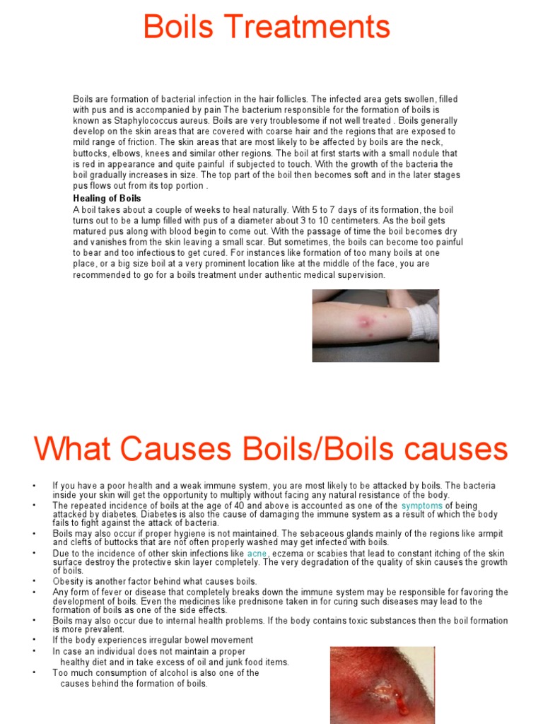 Boils Treatments | PDF | Clinical Medicine | Diseases And Disorders