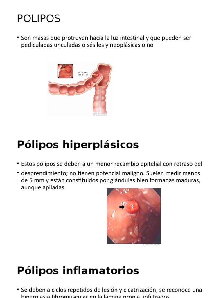 POLIPOS | PDF | Cáncer colonrectal | Biología