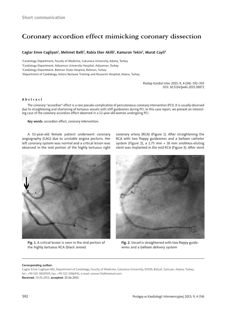 Accordion Effect | Download Free PDF | Percutaneous Coronary ...