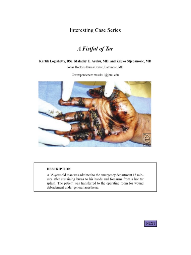 A Fistful of Tar | PDF | Asphalt | Burn