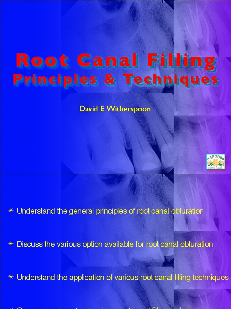 Root Canal Filling: Principles & Techniques | PDF | Nature