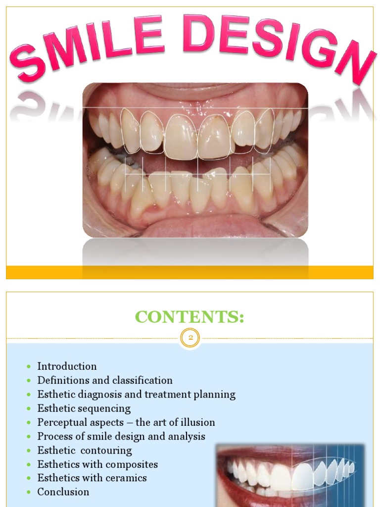 Smile Design | PDF | Color | Periodontology
