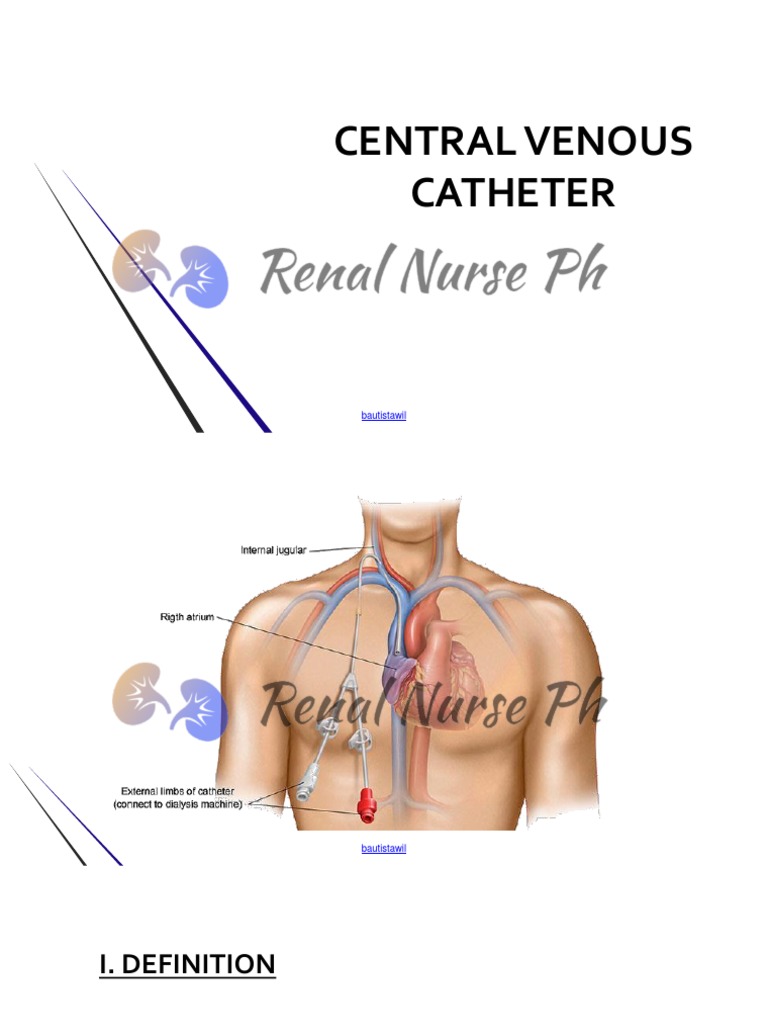 CVC PDF | PDF | Thrombosis | Catheter