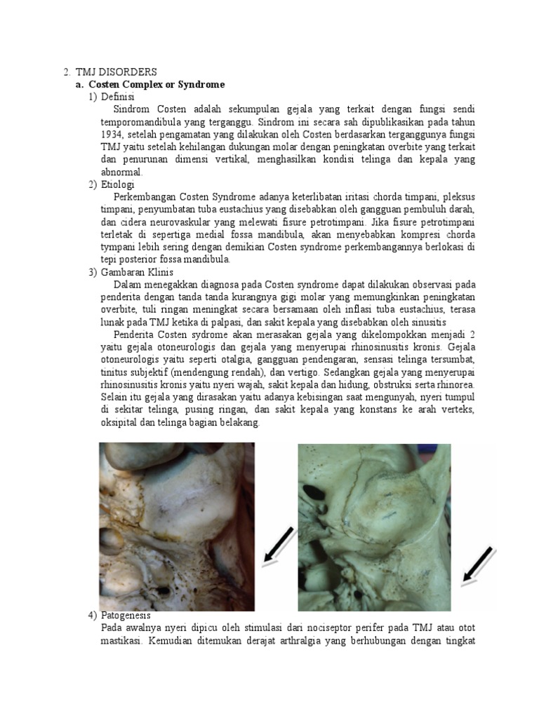 A. Costen Complex or Syndrome | PDF
