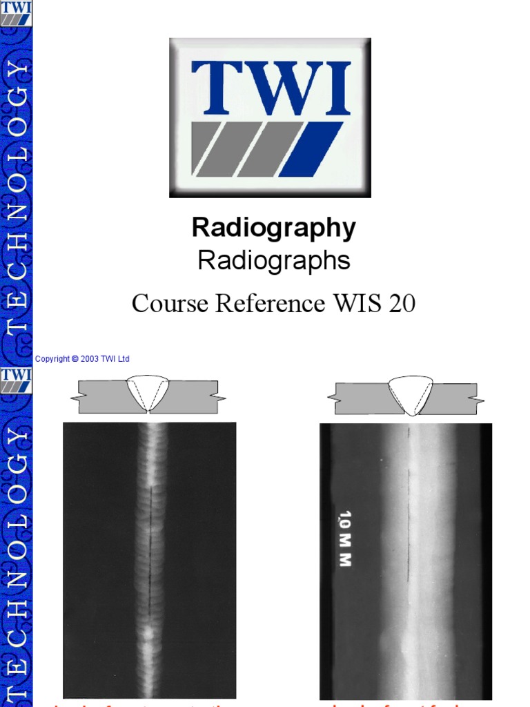 Radiographs Course Reference WIS 20: Radiography | PDF | Joining ...