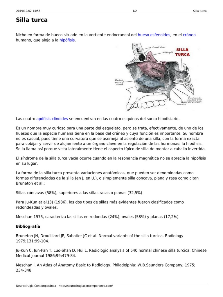 Silla Turca | PDF