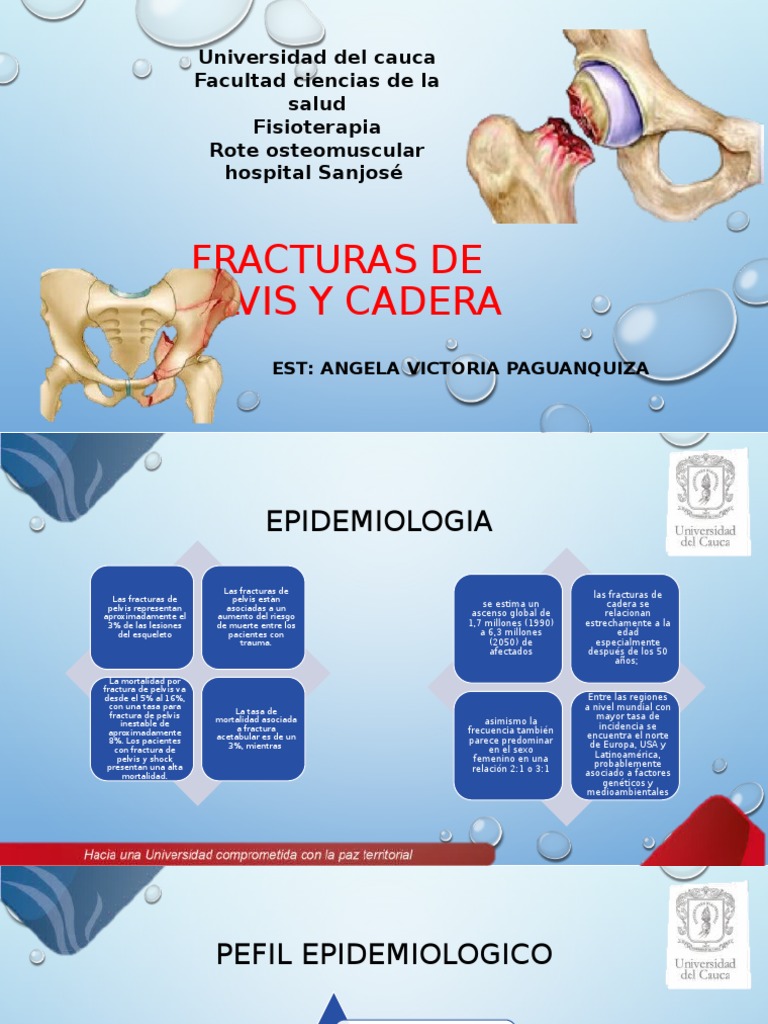 Fracturas De Pelvis Y Cadera – Fracturas de Cadera y Pelvis – BVMEM