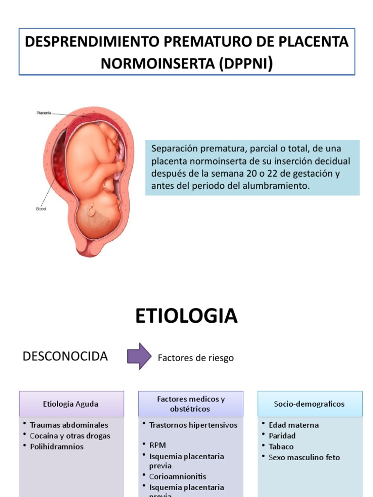 Desprendimiento Prematuro de Placenta Normoinserta (Dppni) | PDF ...