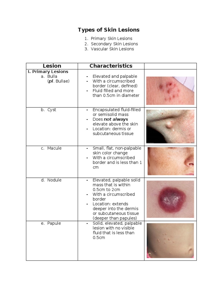 Types of Skin Lesions | PDF | Scar | Skin