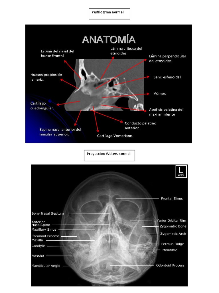 Perfilograma Waters | PDF
