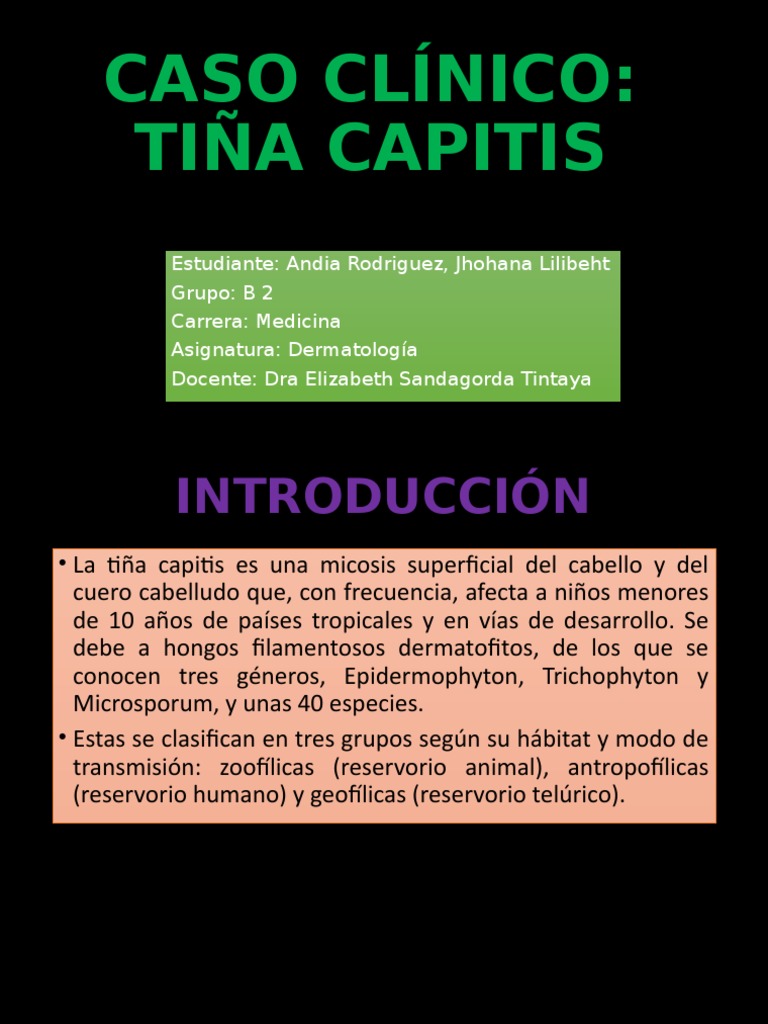Caso Clínico Tiña Capitis | PDF | Condiciones cutáneas | Especialidades ...