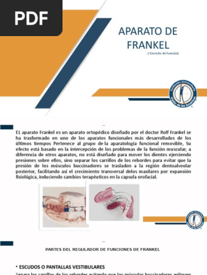 Aparato Frankel