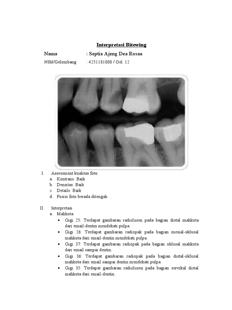 Interpretasi Radiografi Bitewing Gigi | PDF | Sains & Matematika