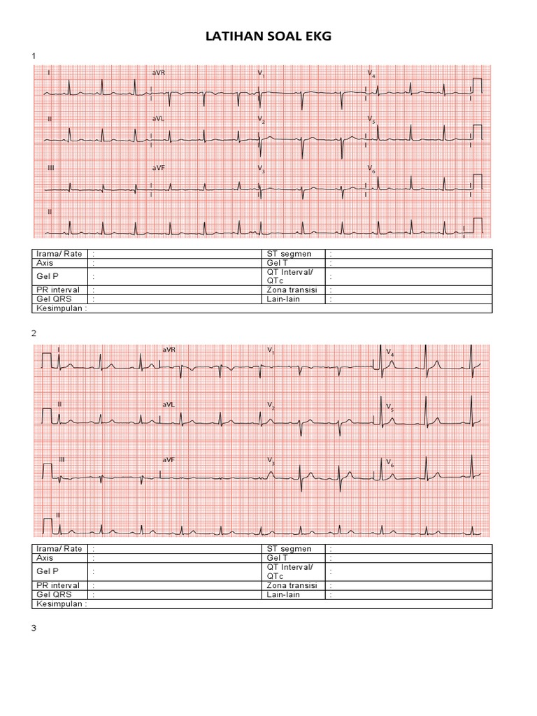 Latihan Soal Ekg | PDF