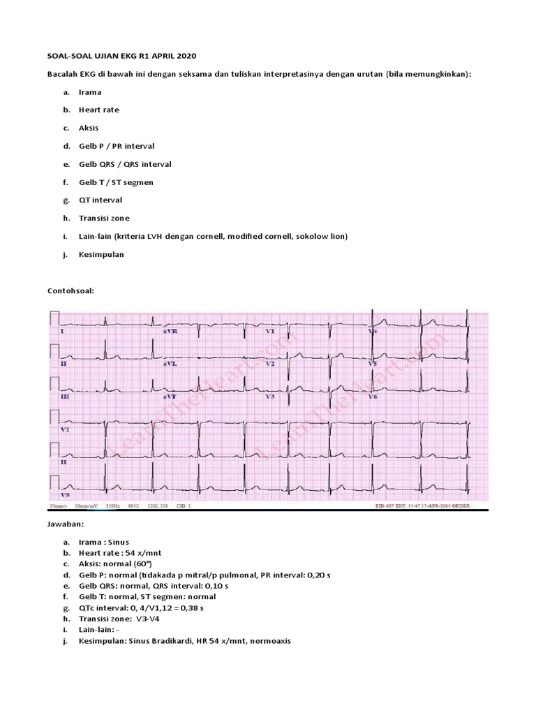 Soal Ekg | PDF | Metode & Bahan Ajar | Sains & Matematika