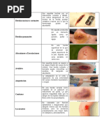 Clasificación de Los Tipos de Heridas | PDF | Piel | Herida
