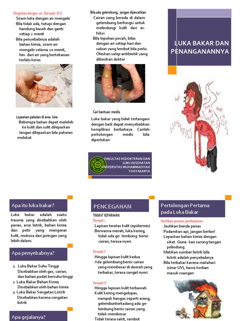 Leaflet Luka Bakar PDF | PDF