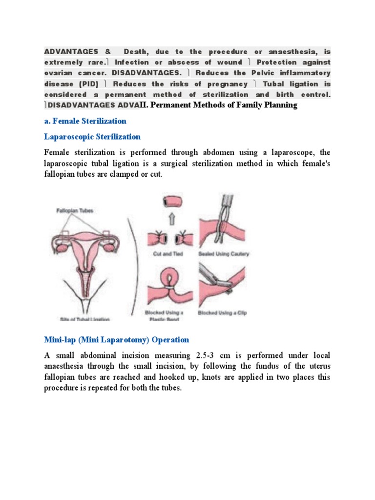 A. Female Sterilization Laparoscopic Sterilization: II. Permanent Methods of Family Planning | PDF