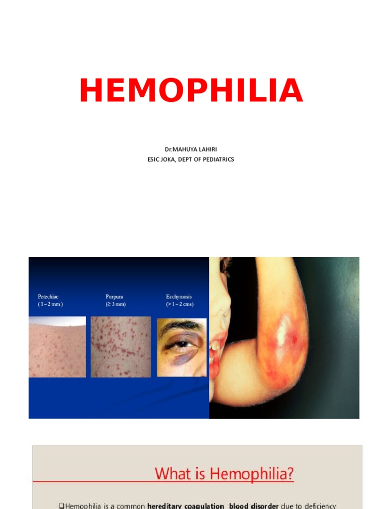 HEMOPHILIA | PDF | Coagulation | Haemophilia