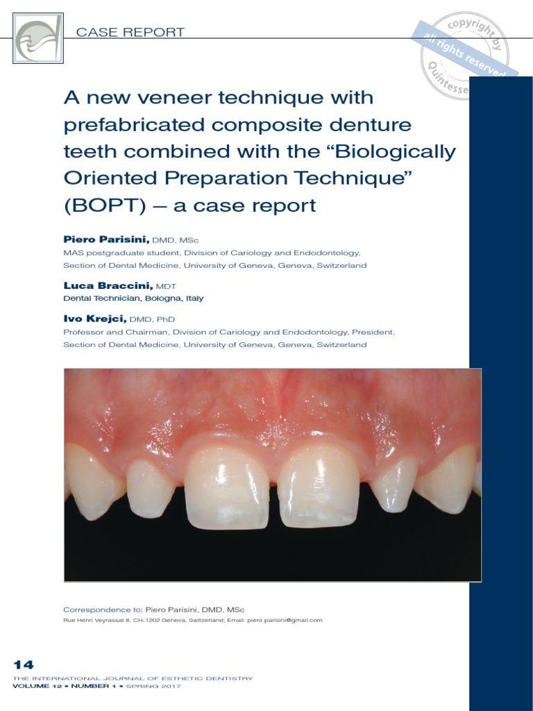 A New Veneer Technique With Prefabricated Composite Denture Teeth ...