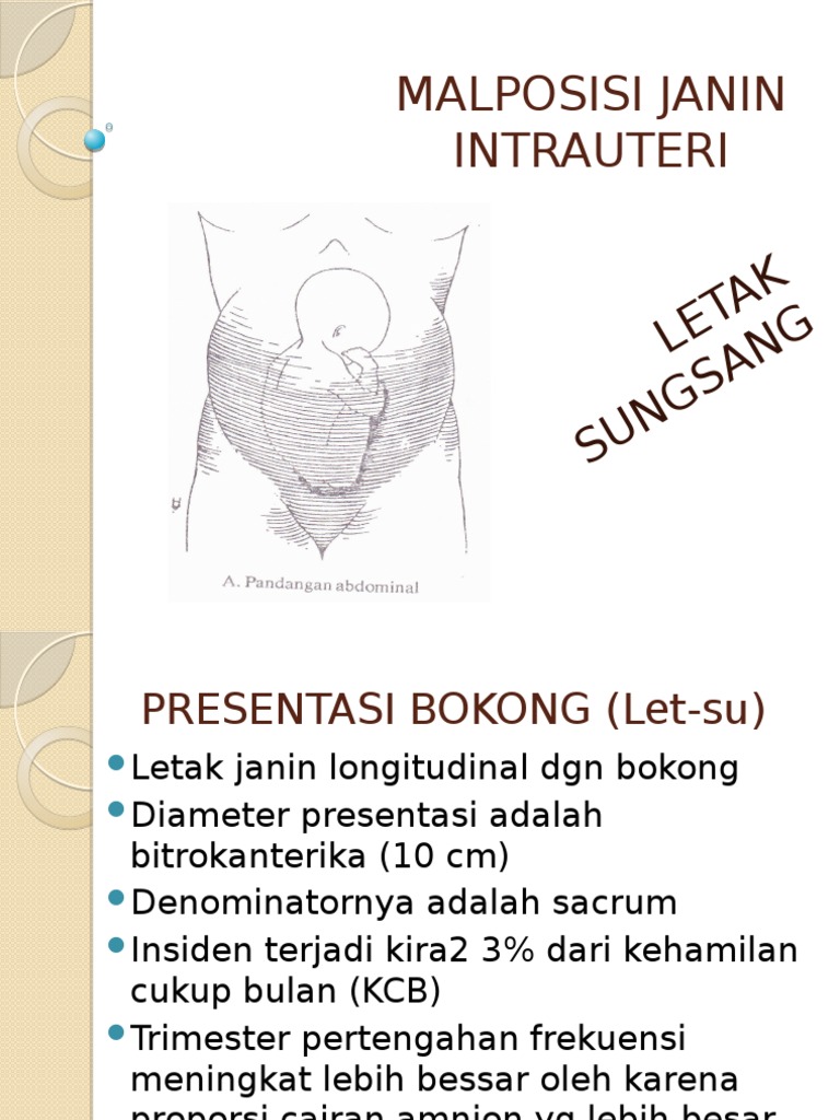 Malposisi Letsu | PDF